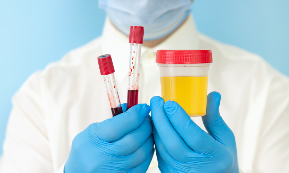 Sangue nelle urine: cos'è l'ematuria, perché succede e cosa fare ...